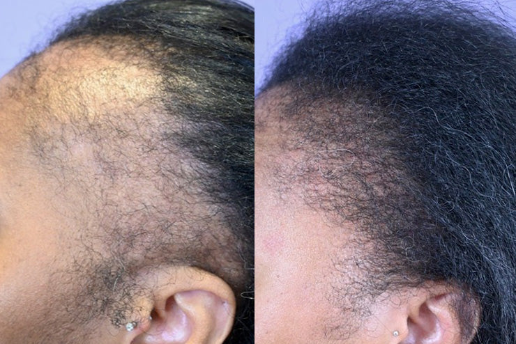 Hair Styling Products and Edge Control for Natural Hair – Grow Your ...