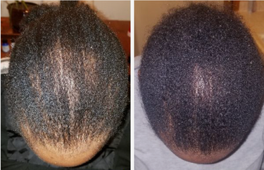 Strong Hold Edge Control & Loc Gel - Grow Your Edges Back