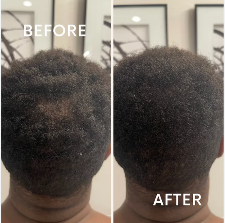 Hair & Edge Growth Oil - Natural Solution by Grow Your Edges Back